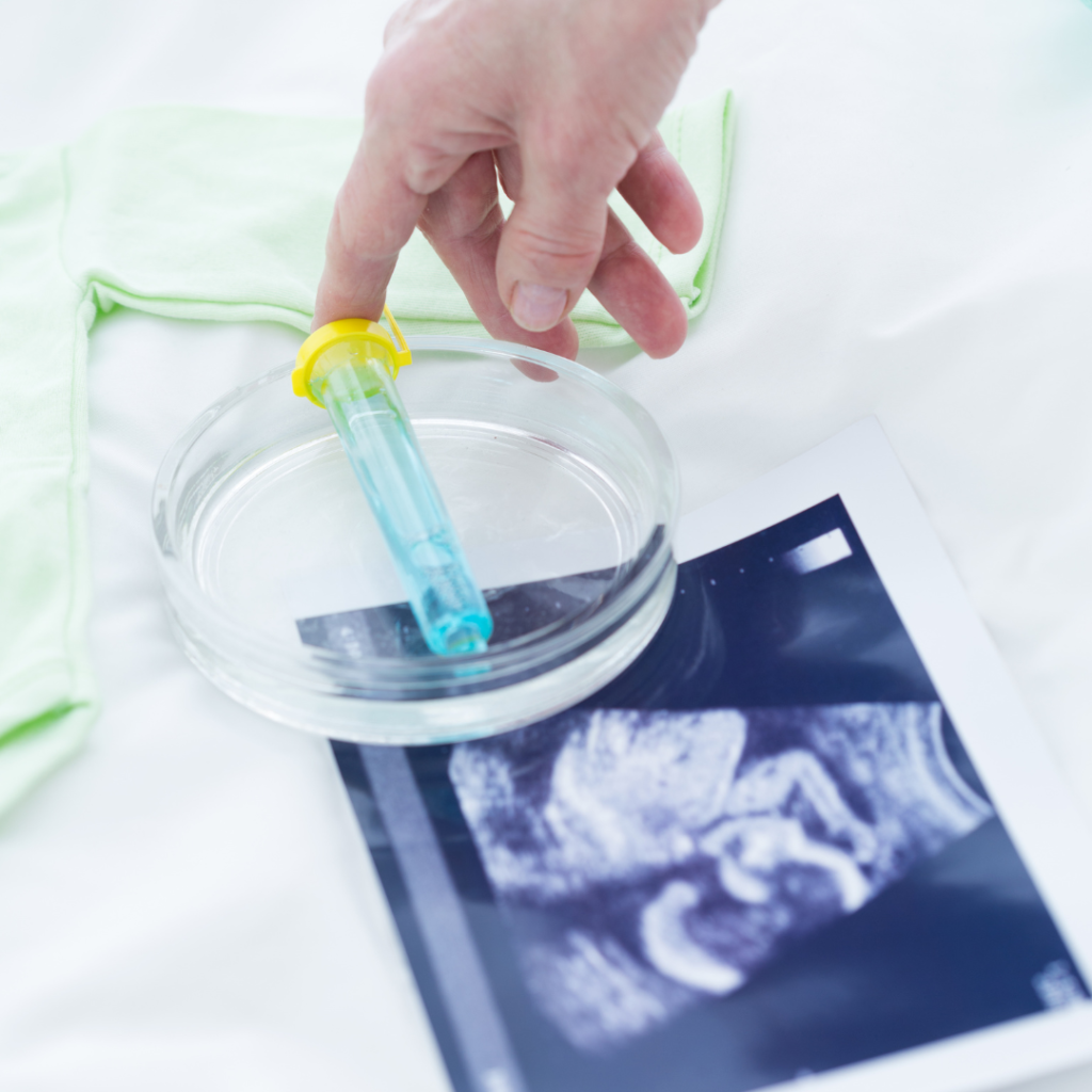 Natural IVF / Mini IVF - Dr. Alberto Félix Atondo